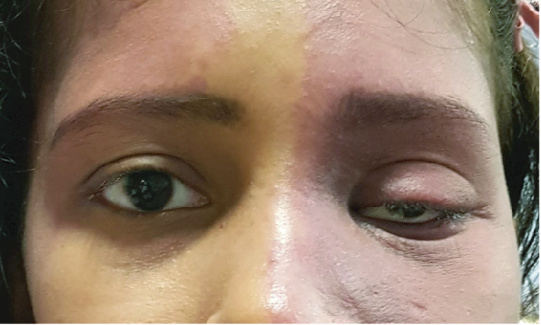 Chevron Eye Hospital